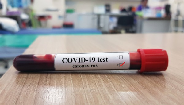COVID-19 pandemic: ROHM Electronics operating at 50% capacity in ...